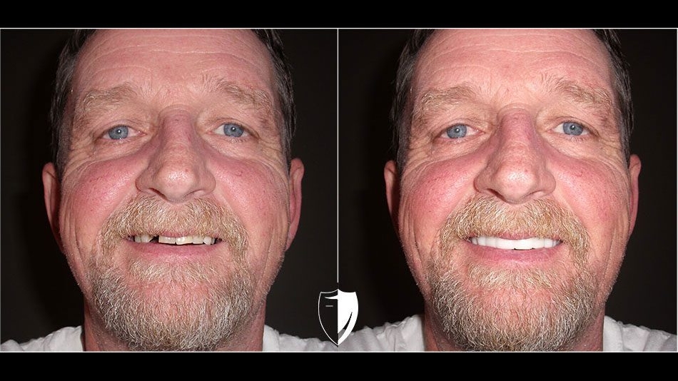 New Smile Landing Page | New Life Smile