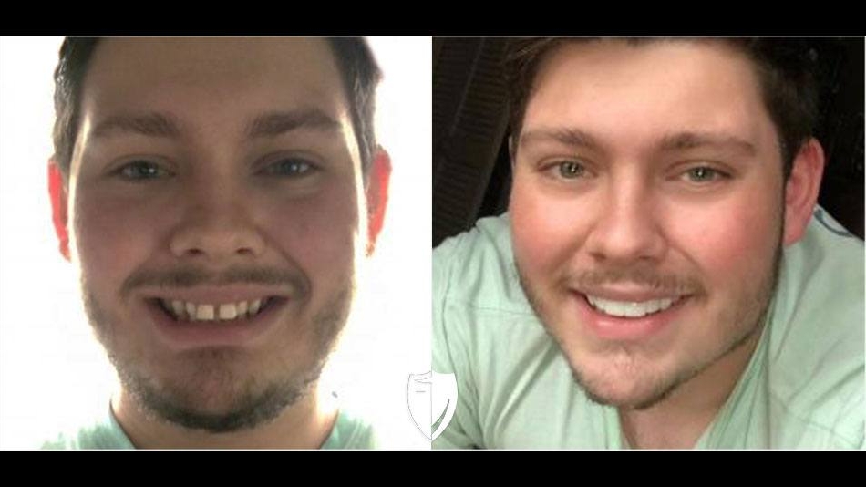 New Smile Landing Page | New Life Smile