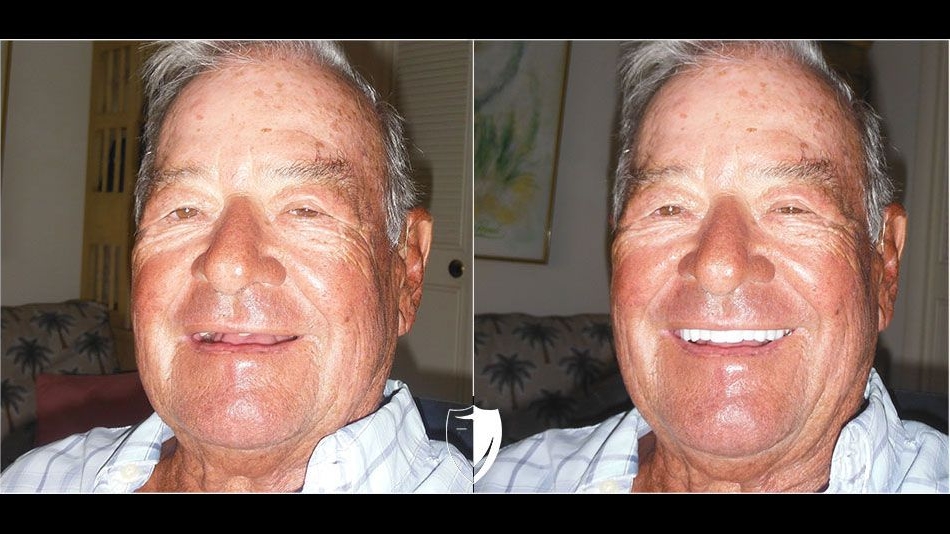 New Smile Landing Page | New Life Smile