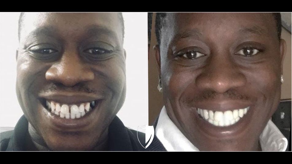 New Smile Landing Page | New Life Smile